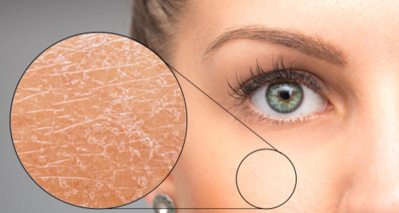 Dr. Amanda Doyle Talks Combining Multiple Treatments To Achieve The ...