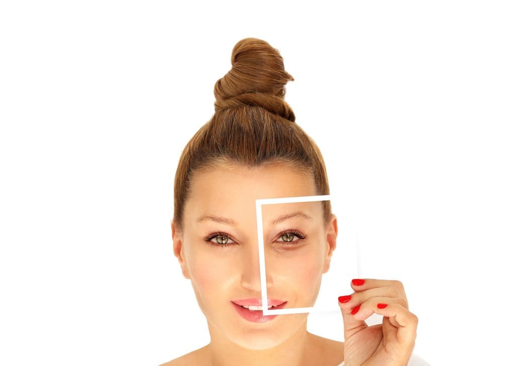 Have A No scar Lower Eyelid Surgery With Dr. Michael Omidi For ...