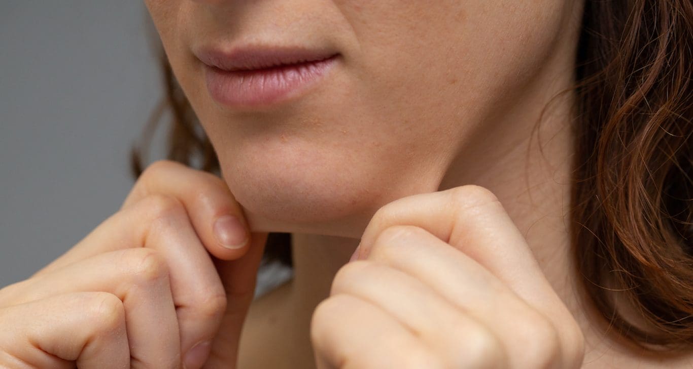 Double Chin? Here's How Chin Liposuction Can Fix That