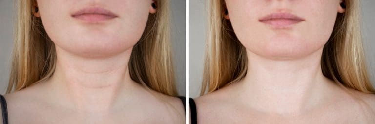 How To Handle Horizontal Neck Lines With A Variety Of Options