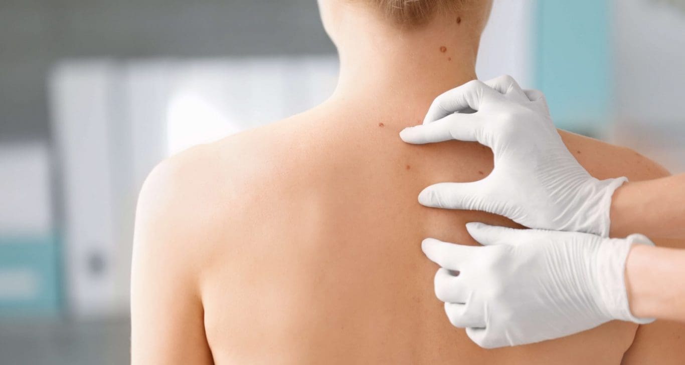 When Is The Right Time To Get A Skin Check? - Haute Beauty by Haute Living