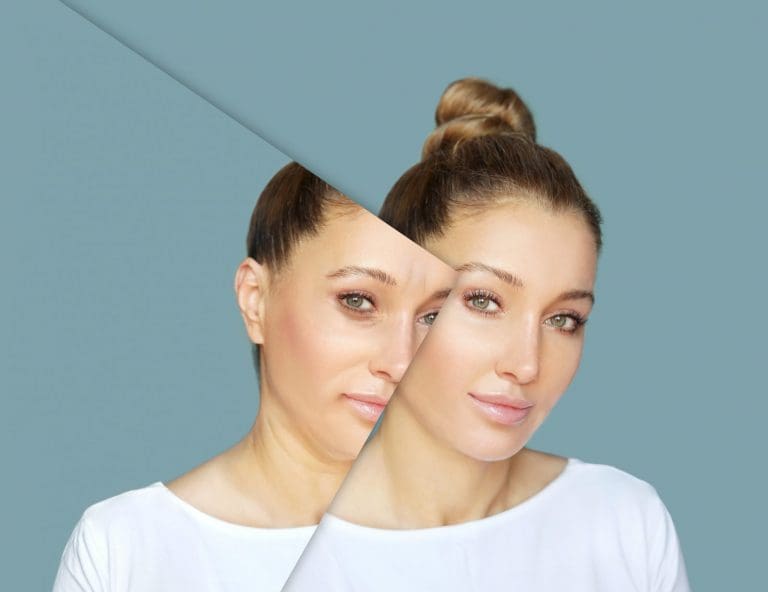 Botox For Your Neck Explained In A Multifunctional Way - Haute Beauty ...