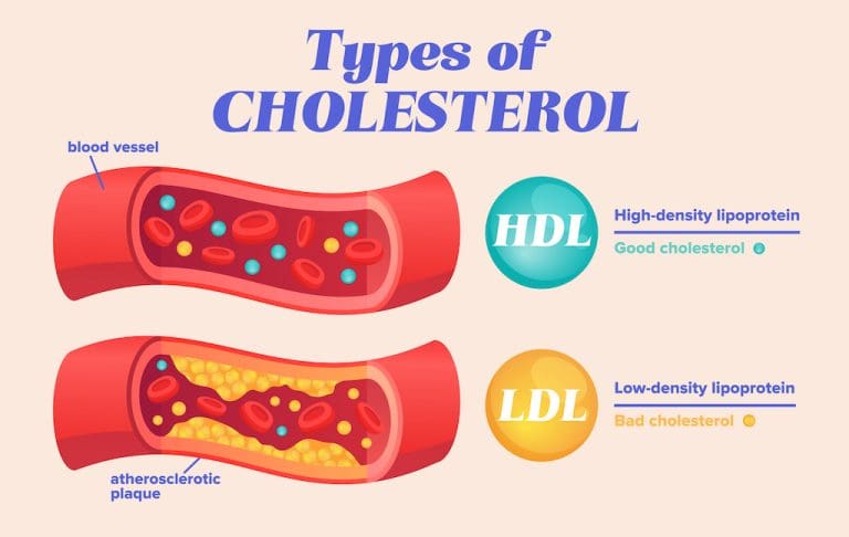 Understanding Cholesterol Levels And How To Fix Them