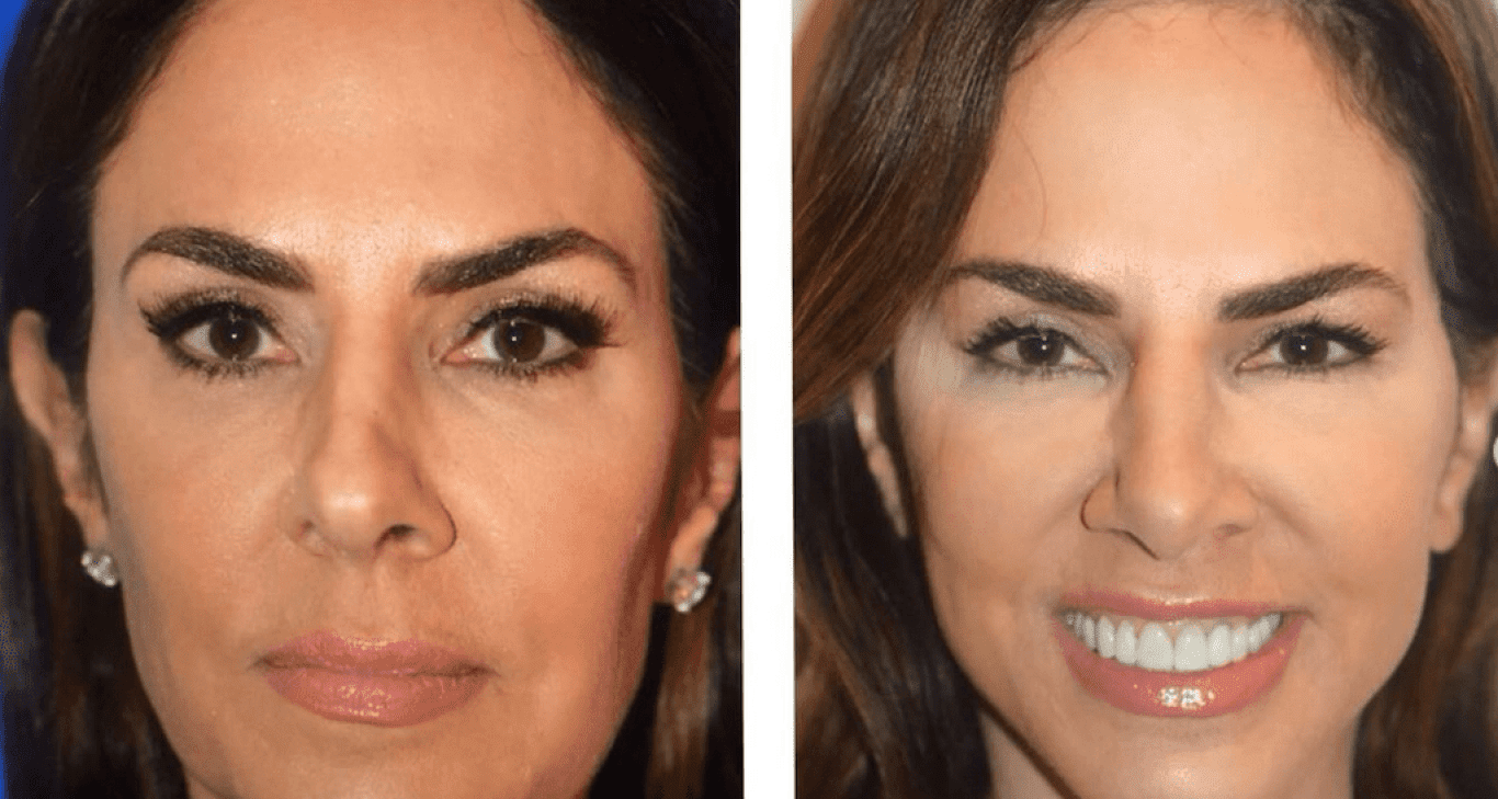 How Dr. Sam Rizk Transformed "RHONJ" Star Jennifer Fessler