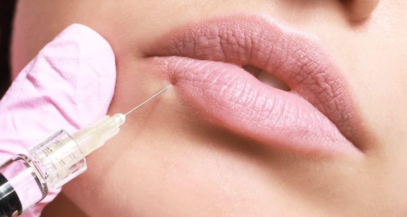 Explore The Unique Way To Natural-Looking Lips At Unique Clinic