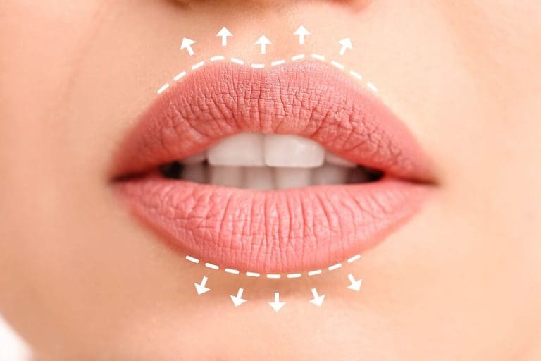 Pout Perfection 101: Guide to Achieving Perfect Lips