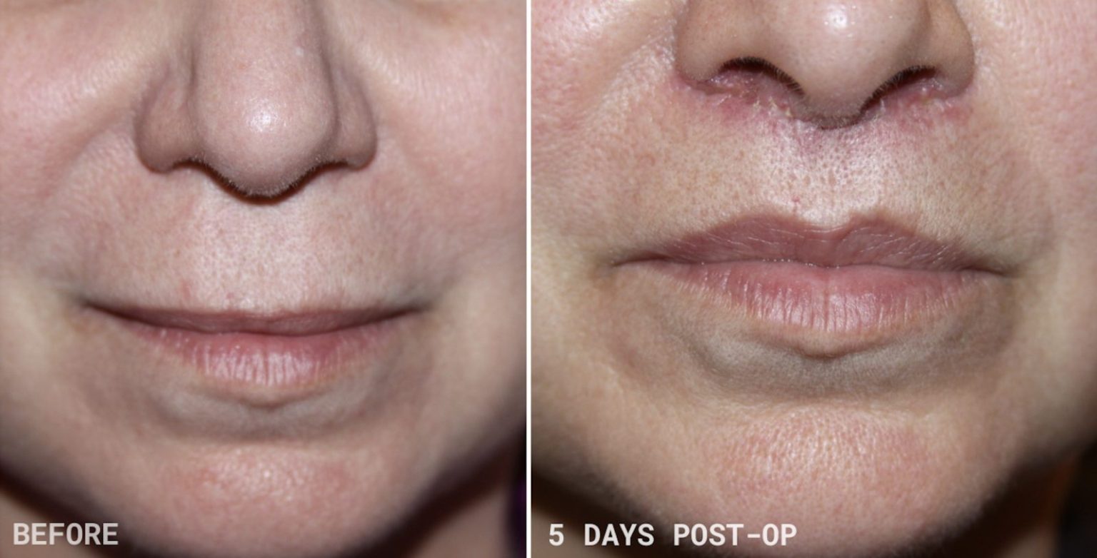 Mouthing Off: Inside Dr. Sam Rizk’s Signature Lip Lift - Haute Beauty ...